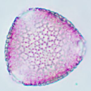 Olive tree allergy - a complete guide w/ photos. » Allerma™