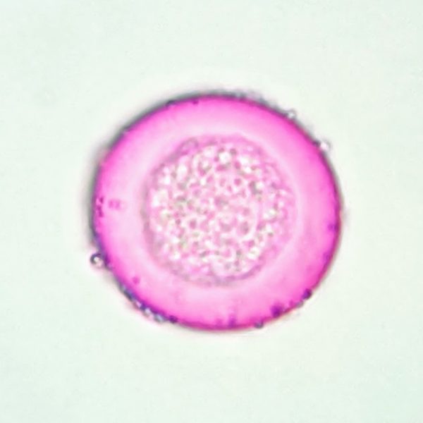 Cypress tree allergy (Cupressus) - a quick guide w/ photos. » Allerma™