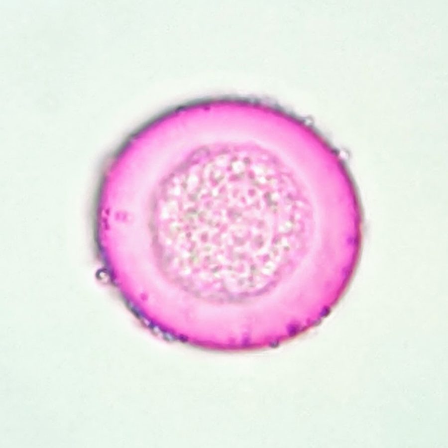 Pollen pictures of allergy plants. » Allerma™