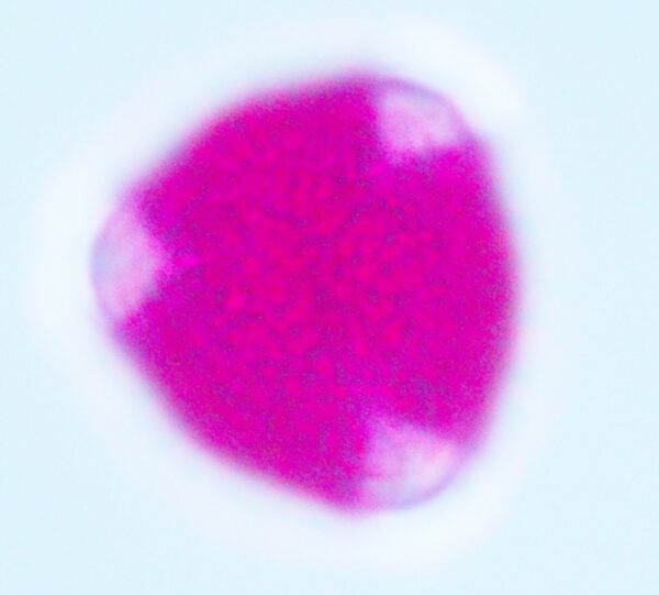 Pollen pictures of allergy plants. » Allerma™